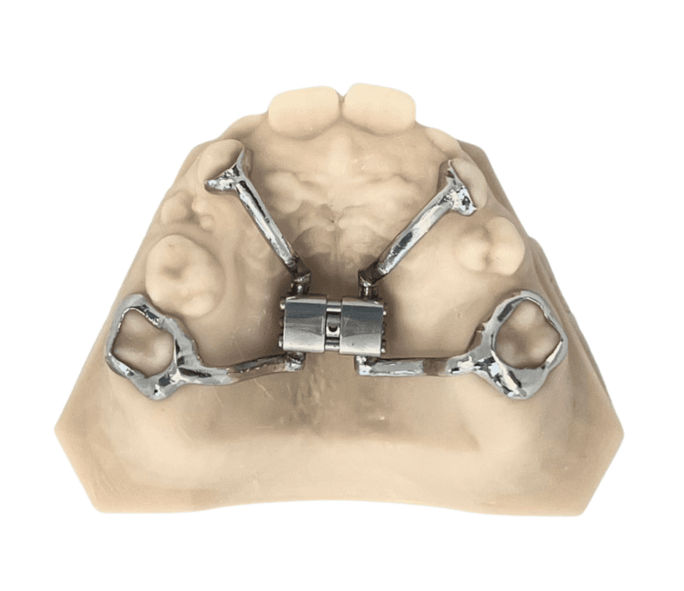 Aparat stały ortodontyczny dla dzieci - OrtoArte